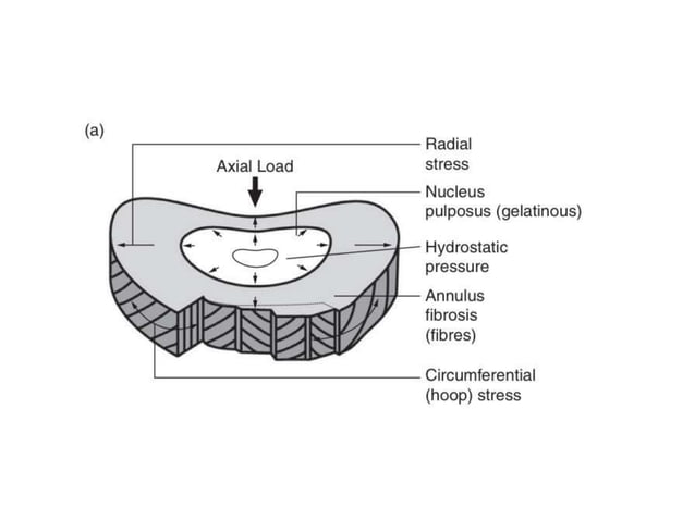 Lumbar intervertebral disc anatomy, biomechanics and pathogenesis of ...