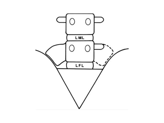 Lumbar intervertebral disc anatomy, biomechanics and pathogenesis of ...