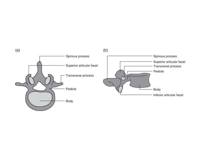 Lumbar intervertebral disc anatomy, biomechanics and pathogenesis of ...