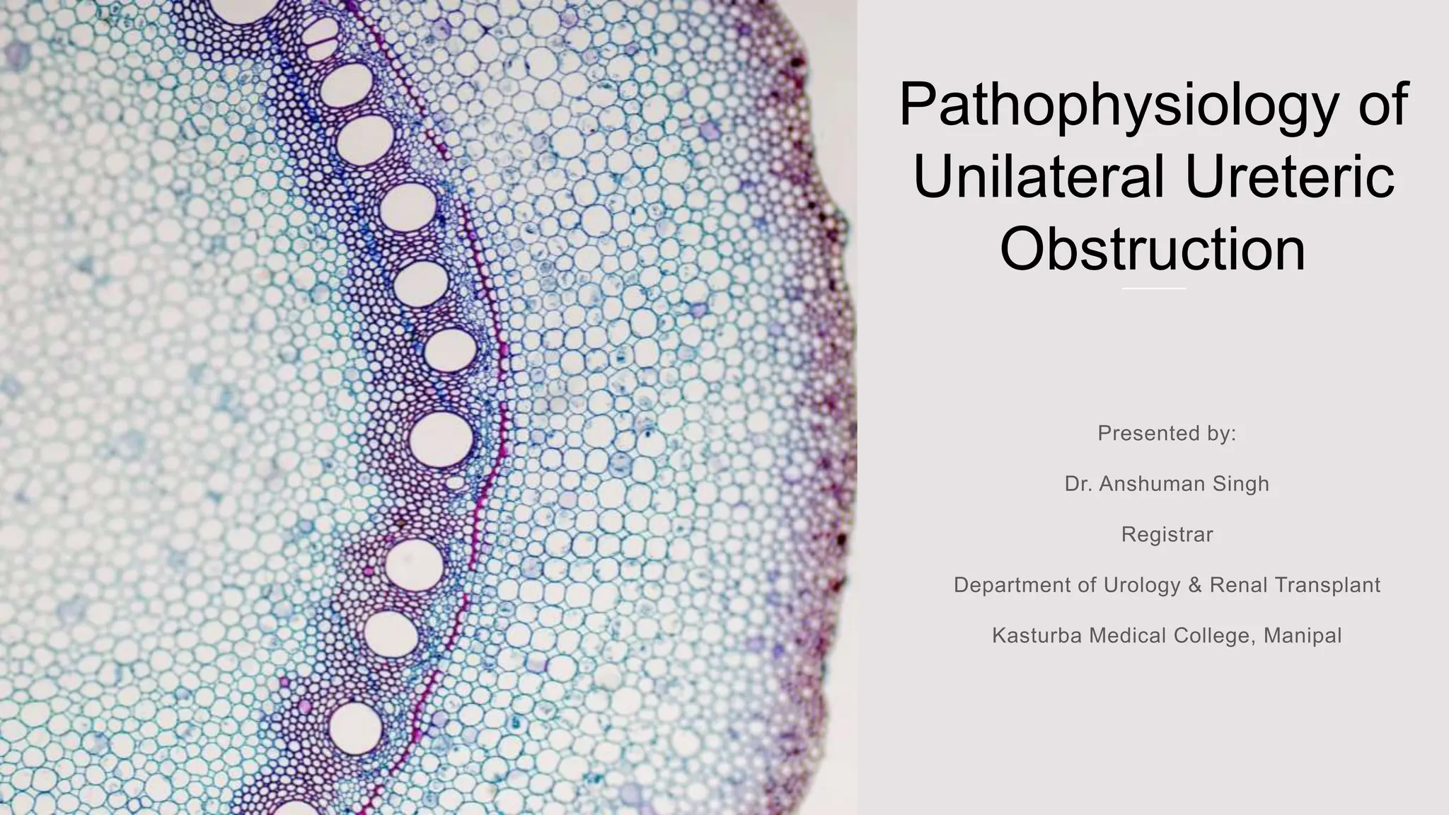 Urinary tract obstruction pathophysiology.pptx