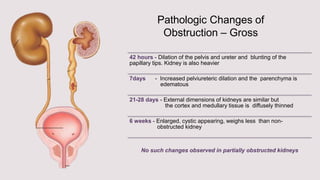 Urinary tract obstruction pathophysiology.pptx