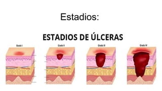 UUP PRACTICA 2 ulceras escaras.pptx
