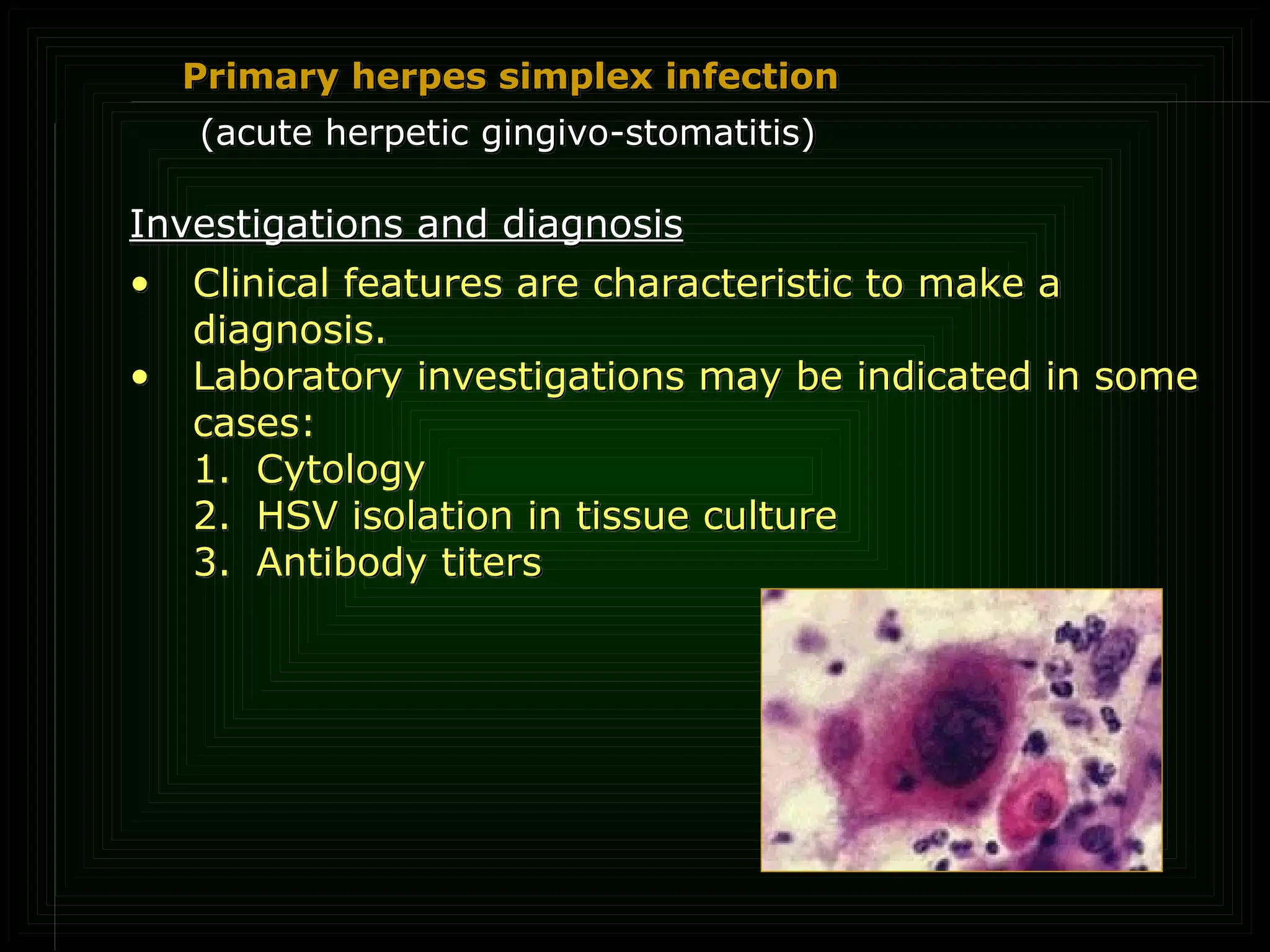 VB Lesions/Mucocutaneous lesions of oral cavity.ppt