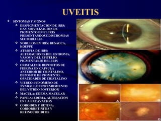 Uvea | PPT