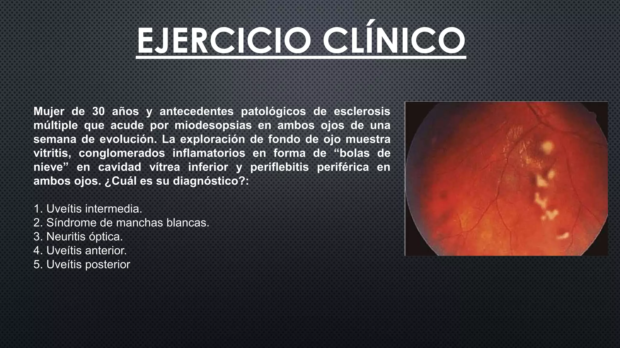 PATOLOGÍAS DE LA UVEA | PPTX