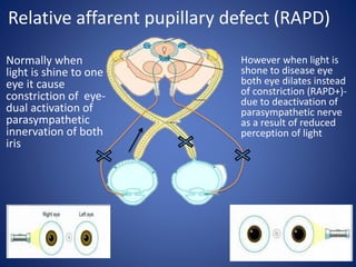Anatomy of Uvea track | PPTX