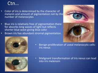 Anatomy of Uvea track | PPTX