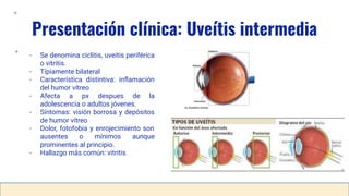 ÚVEA oftamologia: anatomia y manifestaciones clinicas | PDF ...