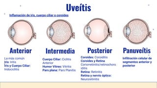 ÚVEA oftamologia: anatomia y manifestaciones clinicas | PDF