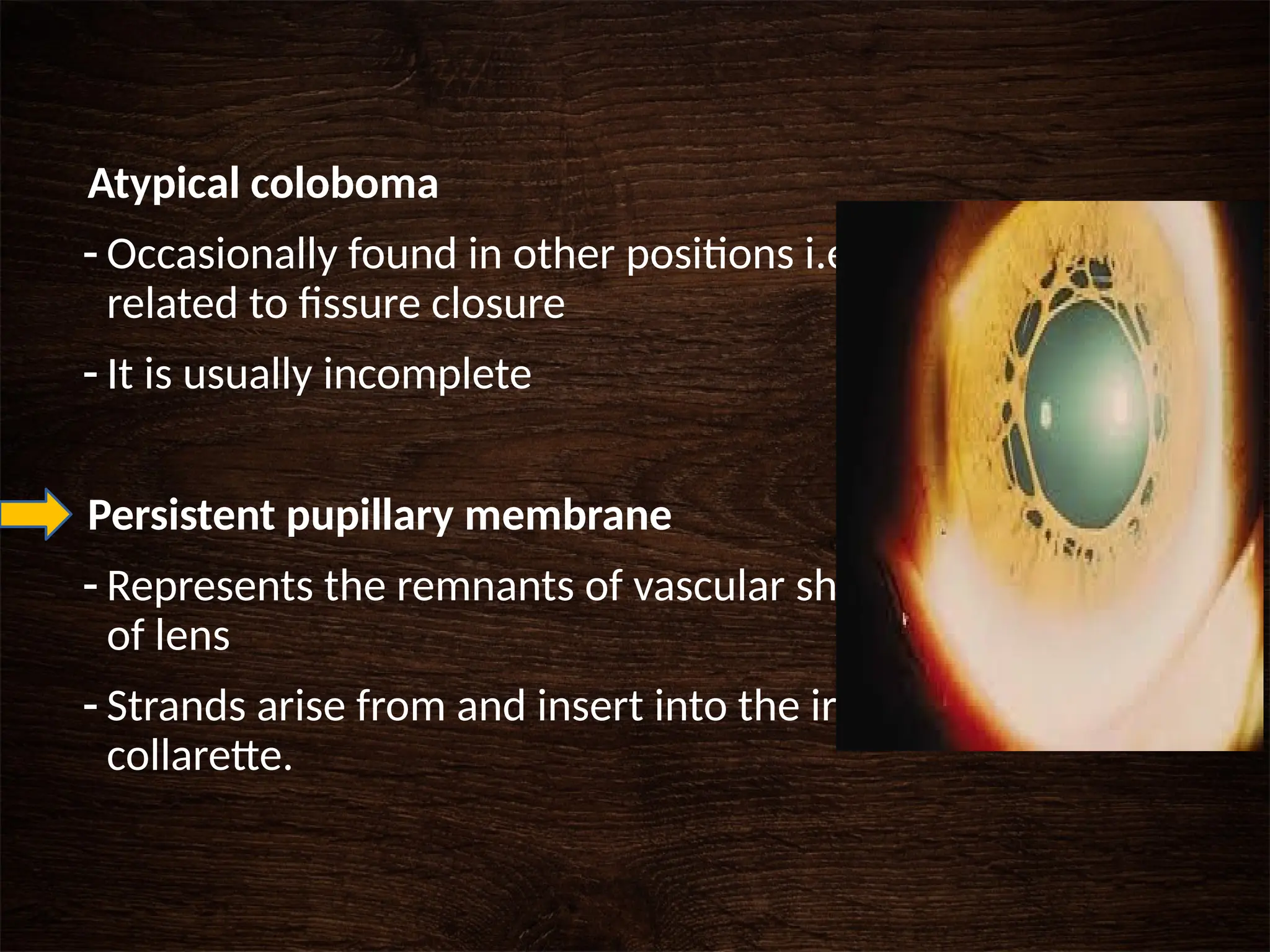 Anatomy and physiology of Uvea- Dr. Moks.pptx