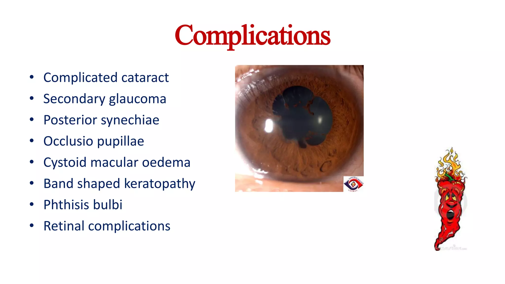 Uveitis | PPTX