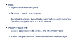 Uveitis | PPTX