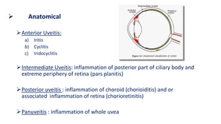 Uveitis | PPTX