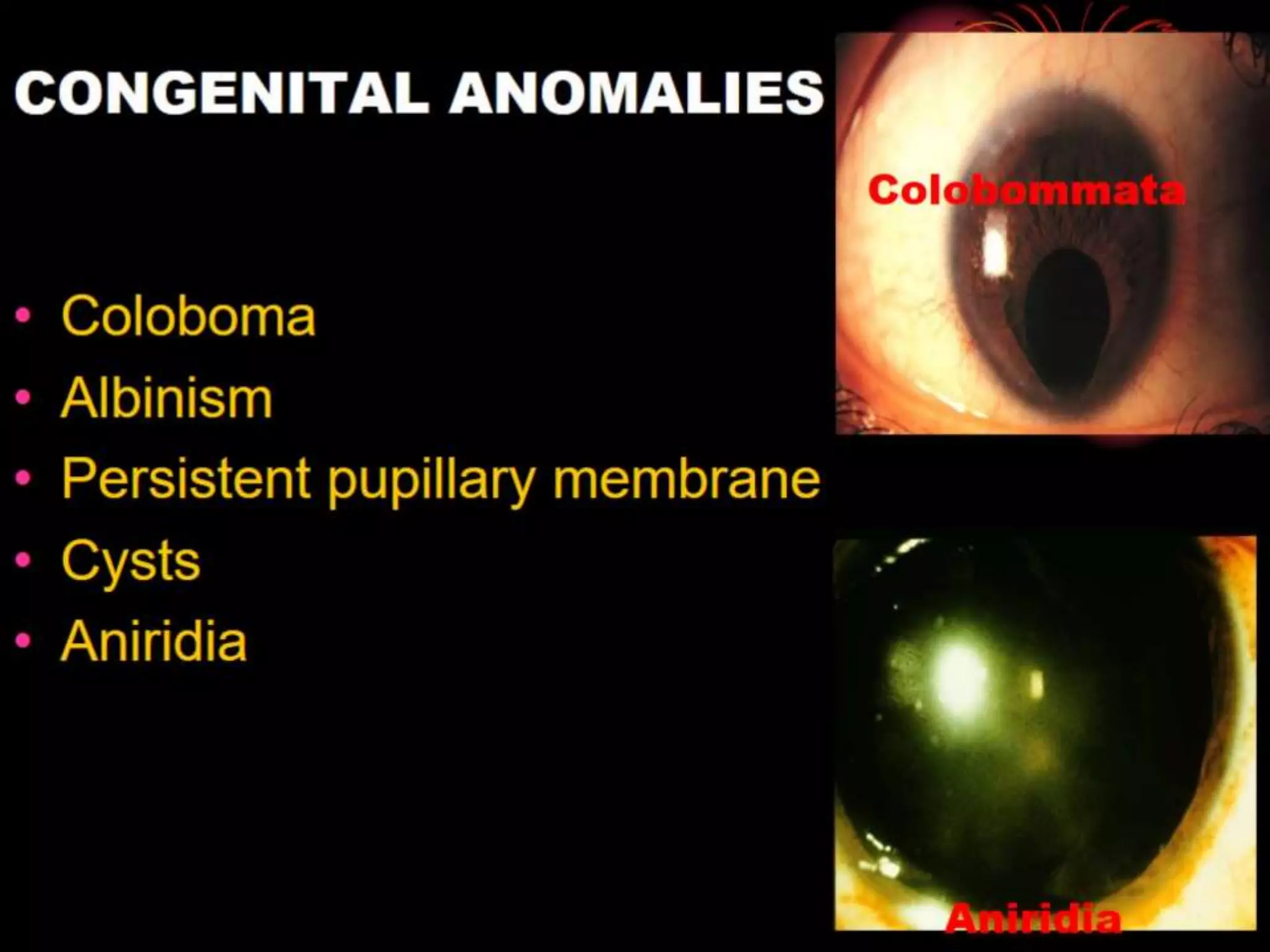 Uveal tract lecture p by dr abdul basir safi | PPTX | Eye and Vision Conditions | Diseases and ...