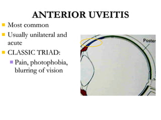 Uvea & sclera | PPT