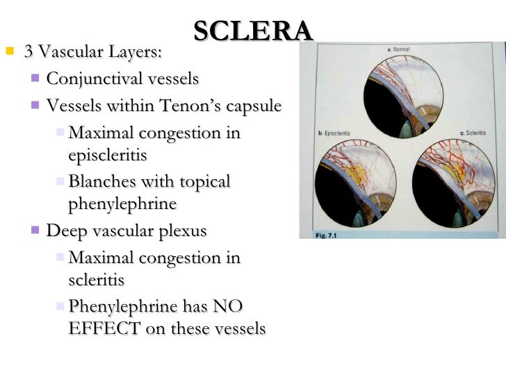 Uvea & sclera