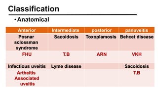 Uveitic glaucoma.pptx