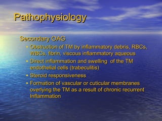 Uveitic Glaucoma | PPT