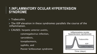 Uveitic glaucoma | PPTX