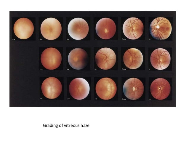 Uveitis investigations