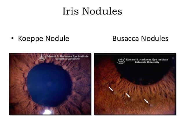 Uveitis investigations