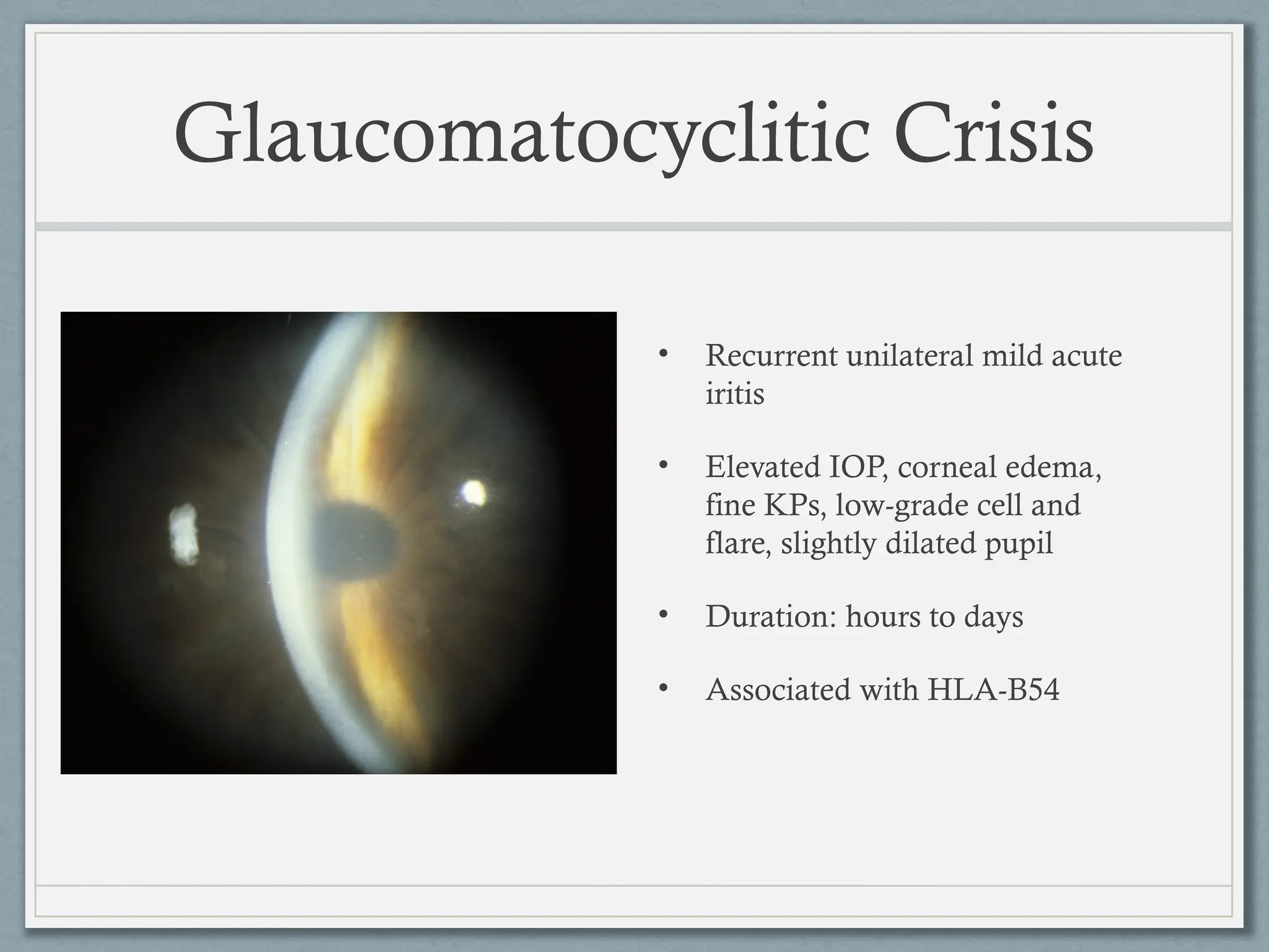 uveitis pptx medicine related condition | PPTX