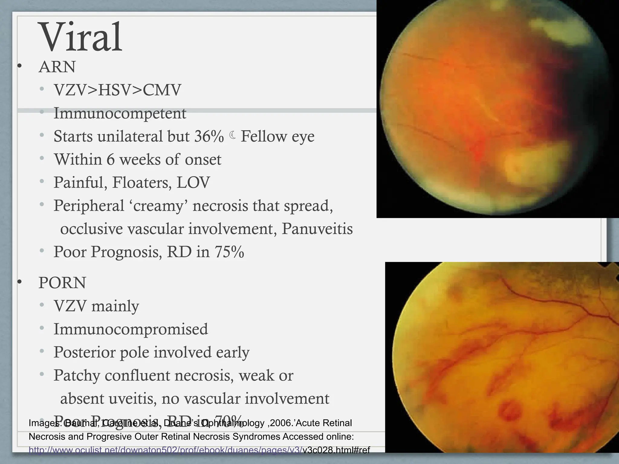 uveitis pptx medicine related condition | PPTX