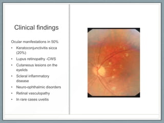 Uveitis | PPTX
