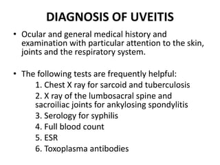 Uveitis | PPTX