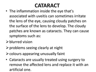 Uveitis | PPTX