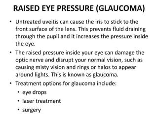 Uveitis | PPTX