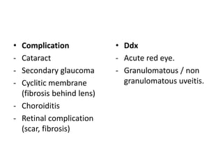 Uveitis | PPT