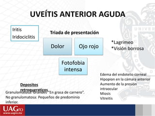 Uveitis | PPTX