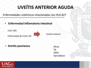 Uveitis | PPTX