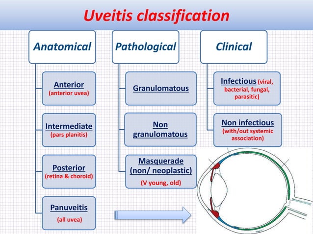 Uveitis | PPTX | Eye and Vision Conditions | Diseases and Conditions