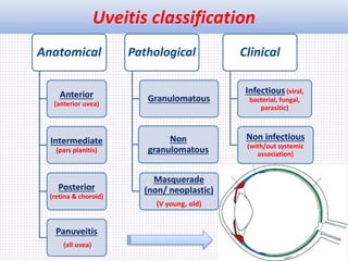 Uveitis | PPT