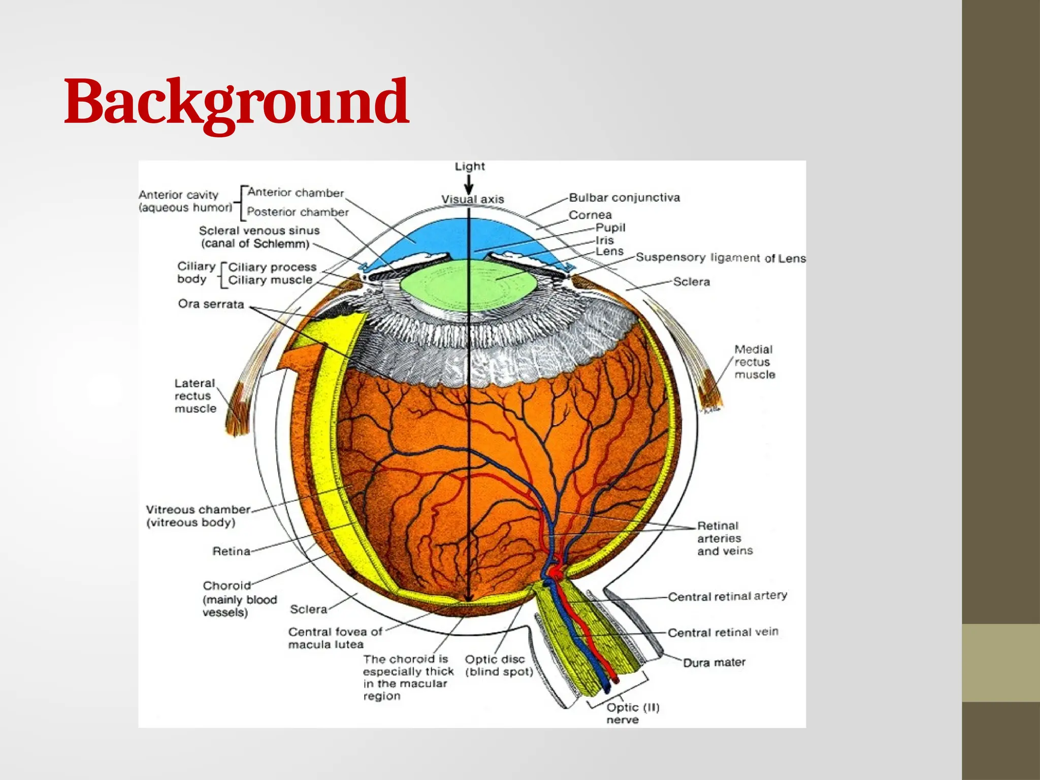 uveitis inflamación de la uvea por patologías | PPT