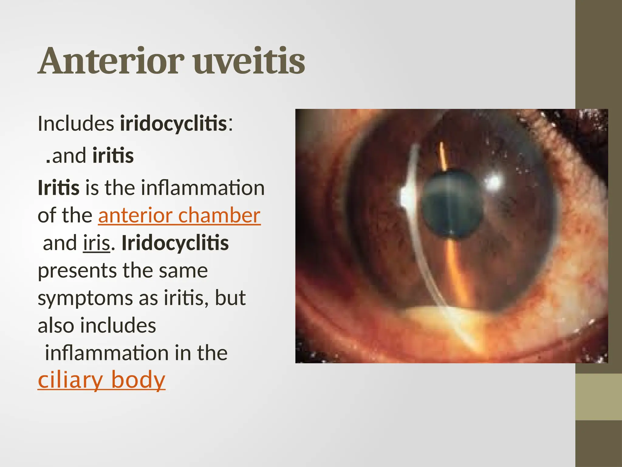 uveitis inflamación de la uvea por patologías | PPT