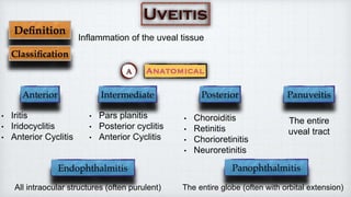 Uveitis | PPTX