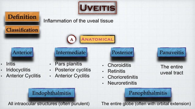Uveitis | PPTX | Eye and Vision Conditions | Diseases and Conditions
