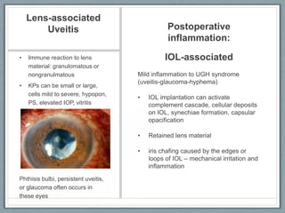 UVEITIS | PDF