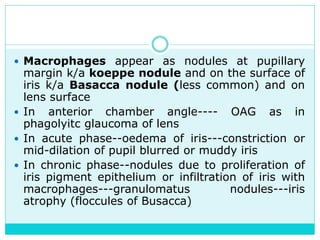 Uveitis | PPTX