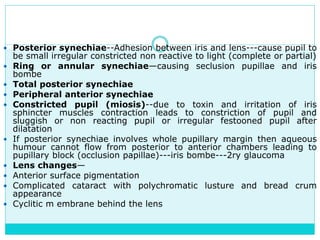 Uveitis | PPTX