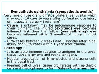 Uveitis | PPTX