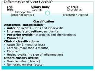 Uveitis | PPTX