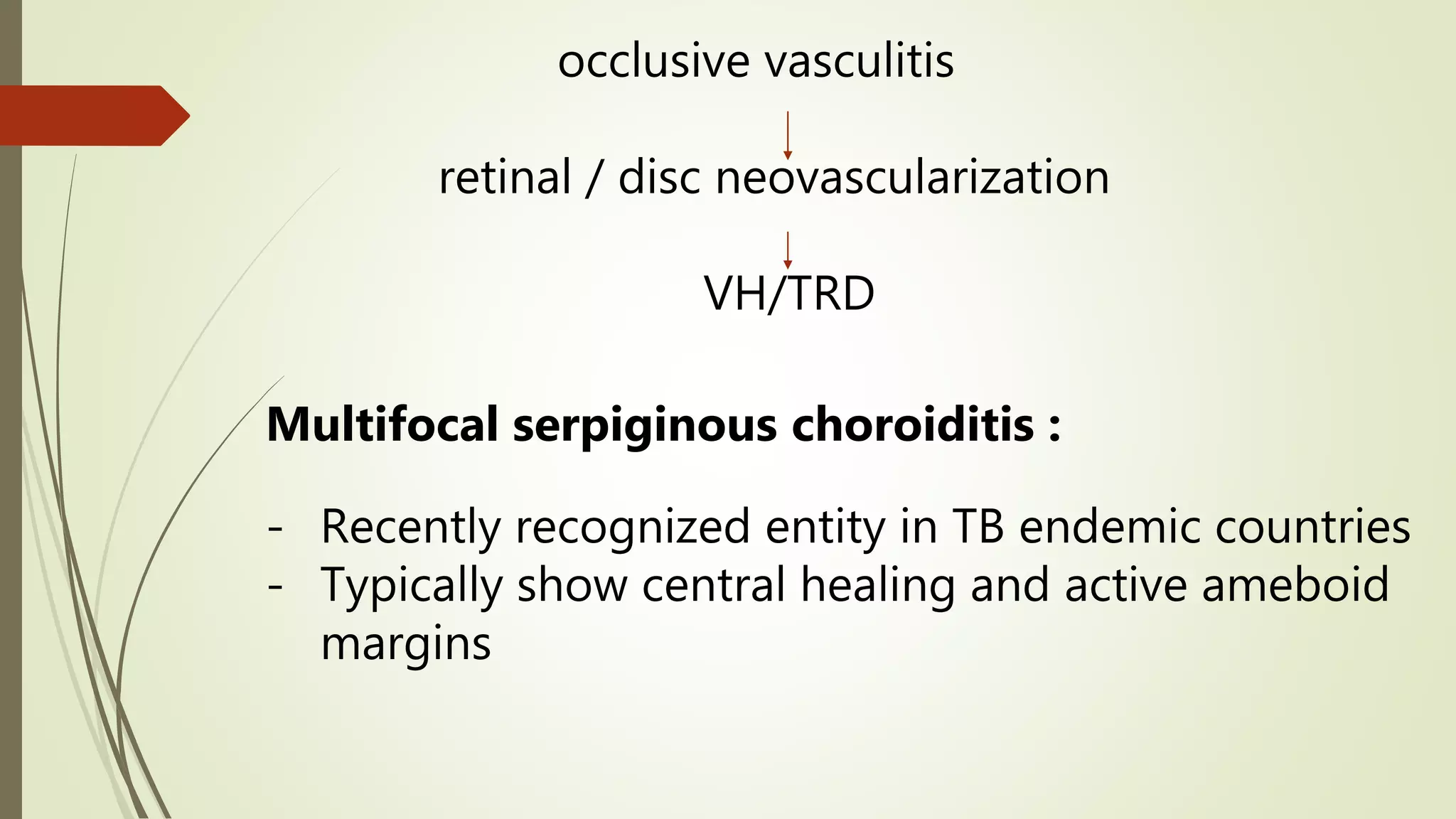 Tubercular Intermediate Uveitis | PPT
