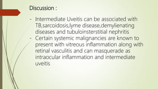 Tubercular Intermediate Uveitis | PPTX