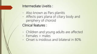 Tubercular Intermediate Uveitis | PPTX