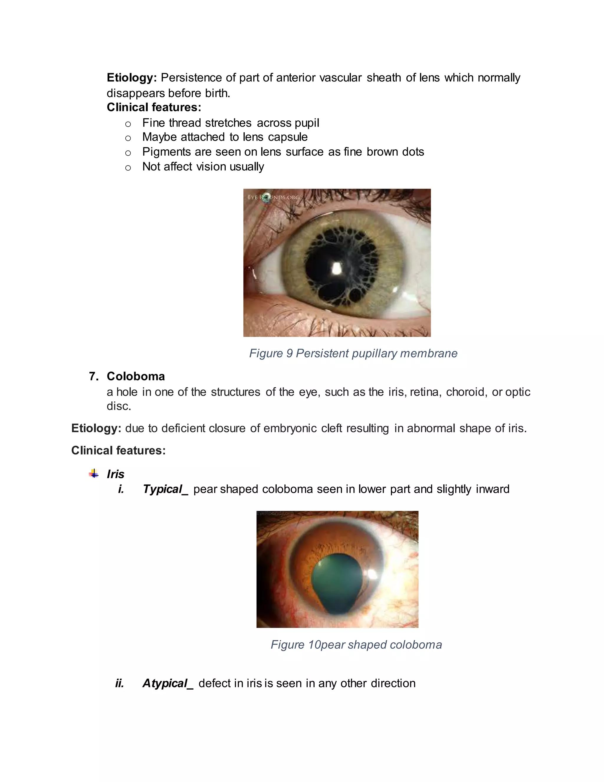 Uveitis (Classification, Panuveitis, Endophthalmitis, Panophthalmitis ...