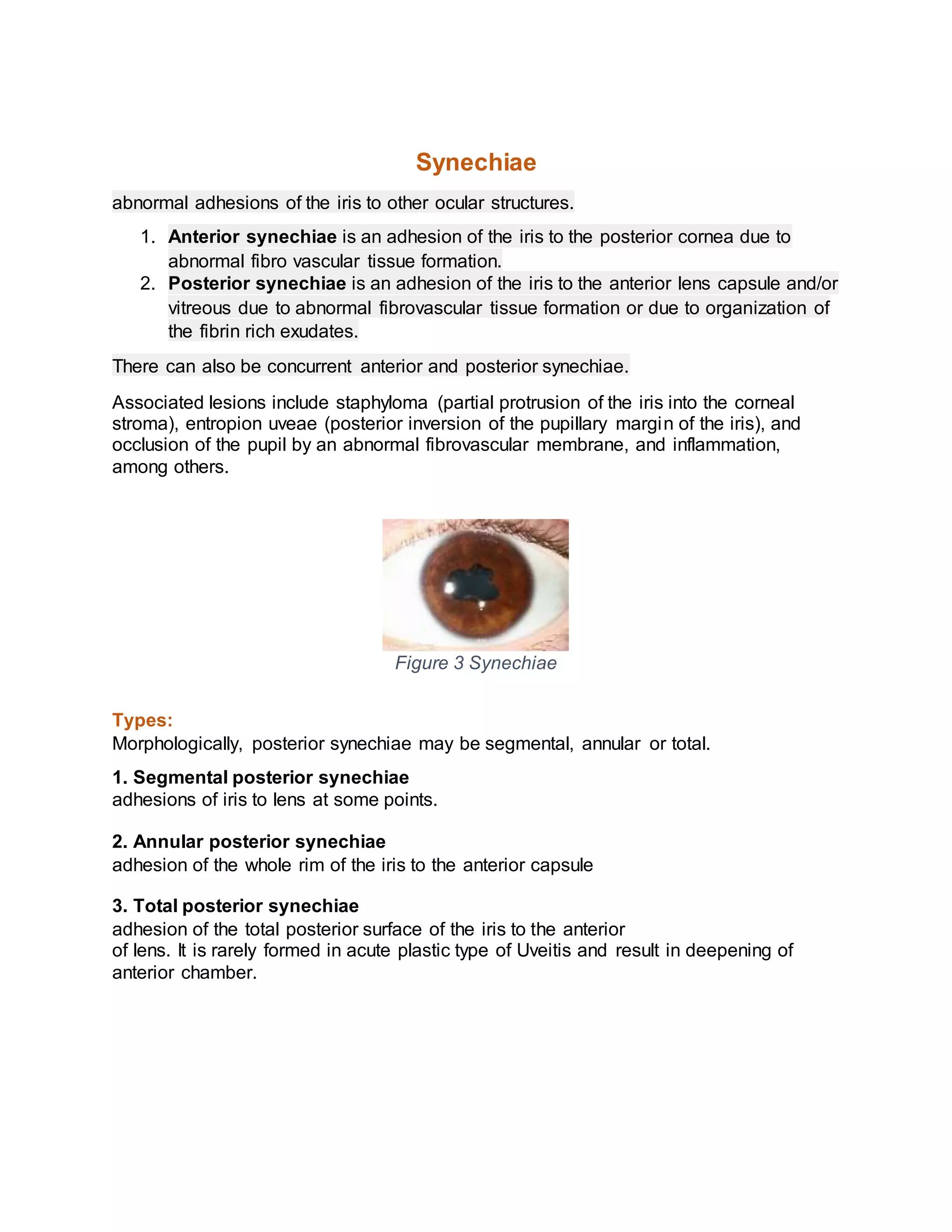 Uveitis (Classification, Panuveitis, Endophthalmitis, Panophthalmitis ...